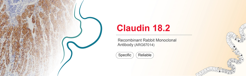 Fight gastric cancer by targeting Claudin 18.2 - News - Company - arigobio