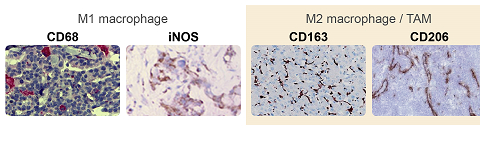 Tumor Microenvironment (TME) - Company - arigobio