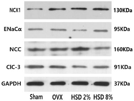 anti-SLC12A3 NCC 抗体 (ARG22199) - arigobio