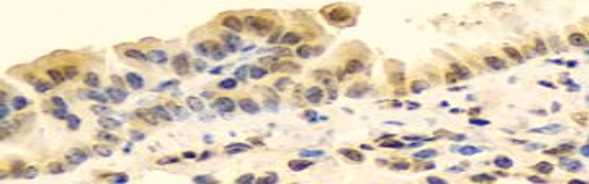 anti-CALCB 抗体 (ARG56241) - arigobio 中国