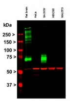 anti-MAP2 抗体 [2C4] (ARG10720) - arigobio