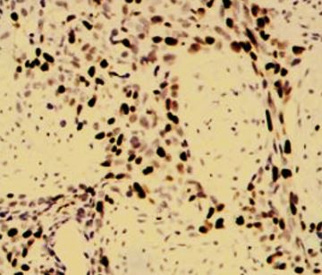 anti-Ki-67 抗体 (ARG57562) - arigobio 中国