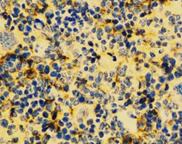 anti-CD278 ICOS 抗体 (ARG58076) - arigobio 中国