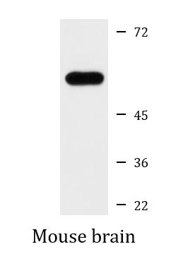 anti-FOXP3 抗体 (ARG59288) - arigobio 中国