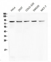 anti-RNF43 抗体 (ARG59435) - arigobio