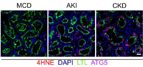 anti-4 Hydroxynonenal 抗体 (ARG23967) - arigobio