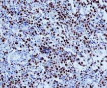 anti-IRF4 MUM1 抗体 [SQab20188] (ARG66755) - arigobio