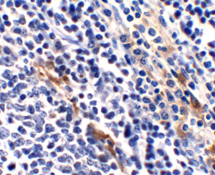 anti-ZBP1 抗体 (ARG46723) - arigobio