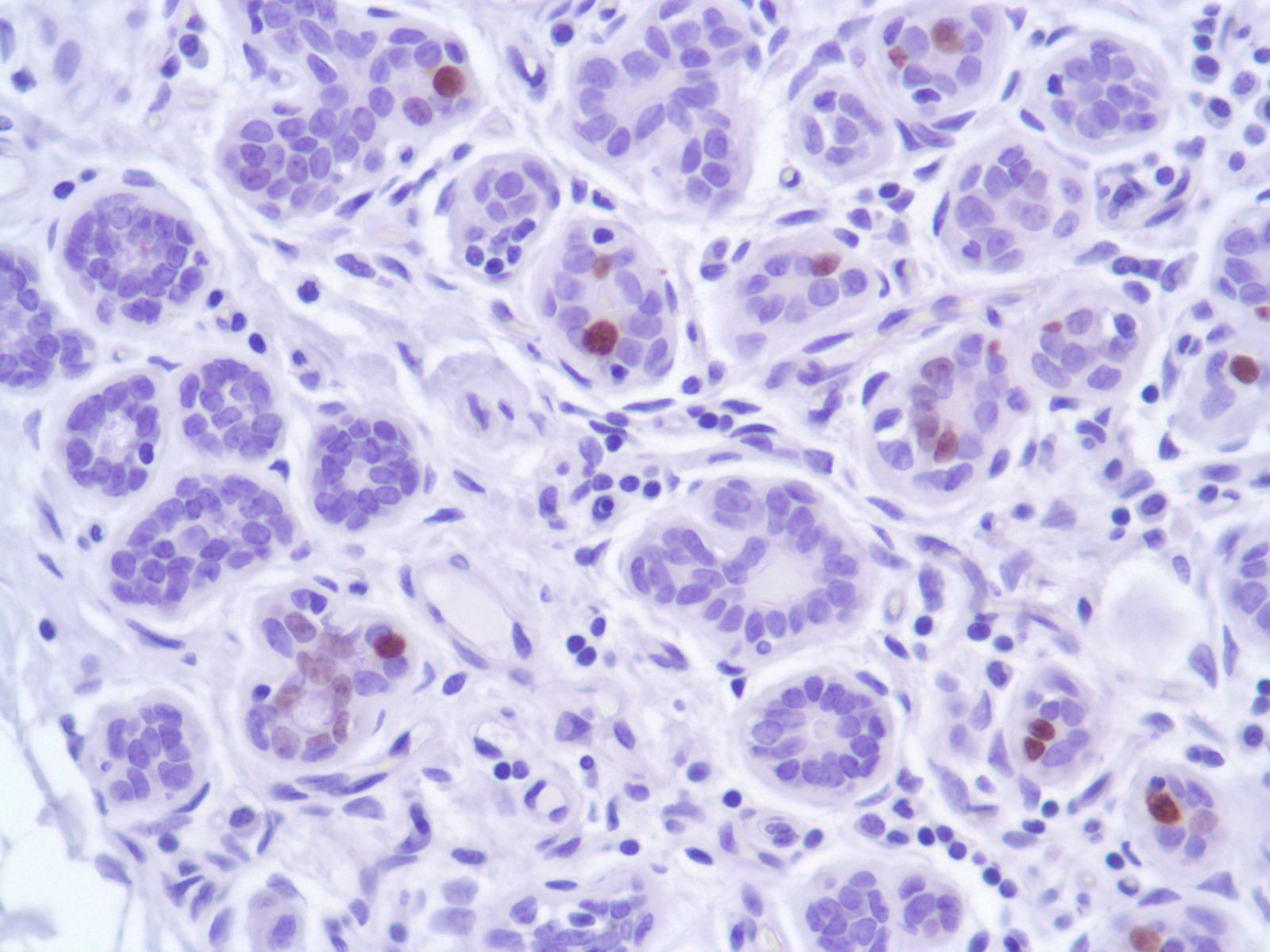 anti-Ki-67 antibody [SP6] (ARG53222) - Product - Arigo biolaboratories