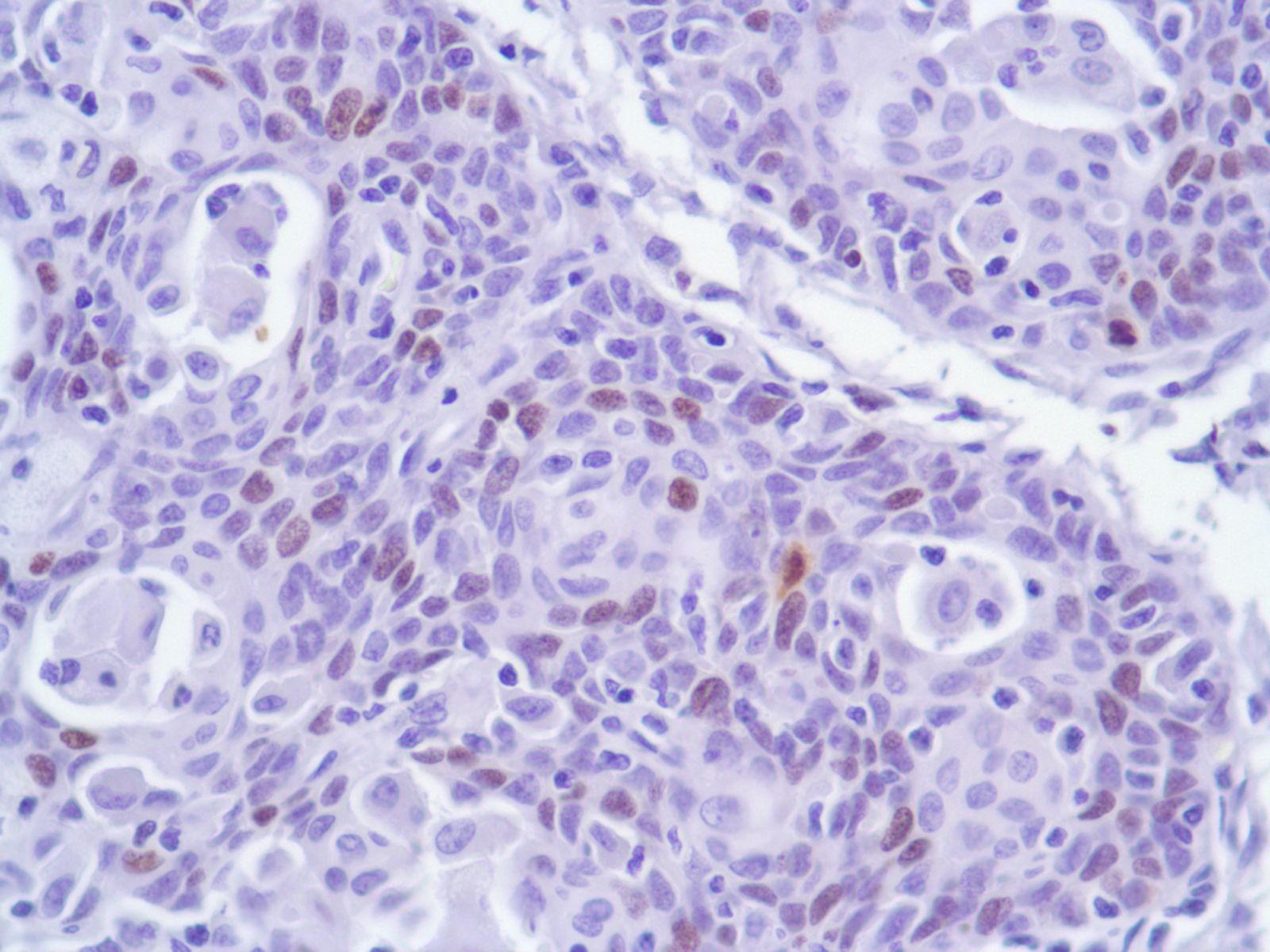 anti-Ki-67 抗体 [SP6] (ARG53222) - arigobio 中国