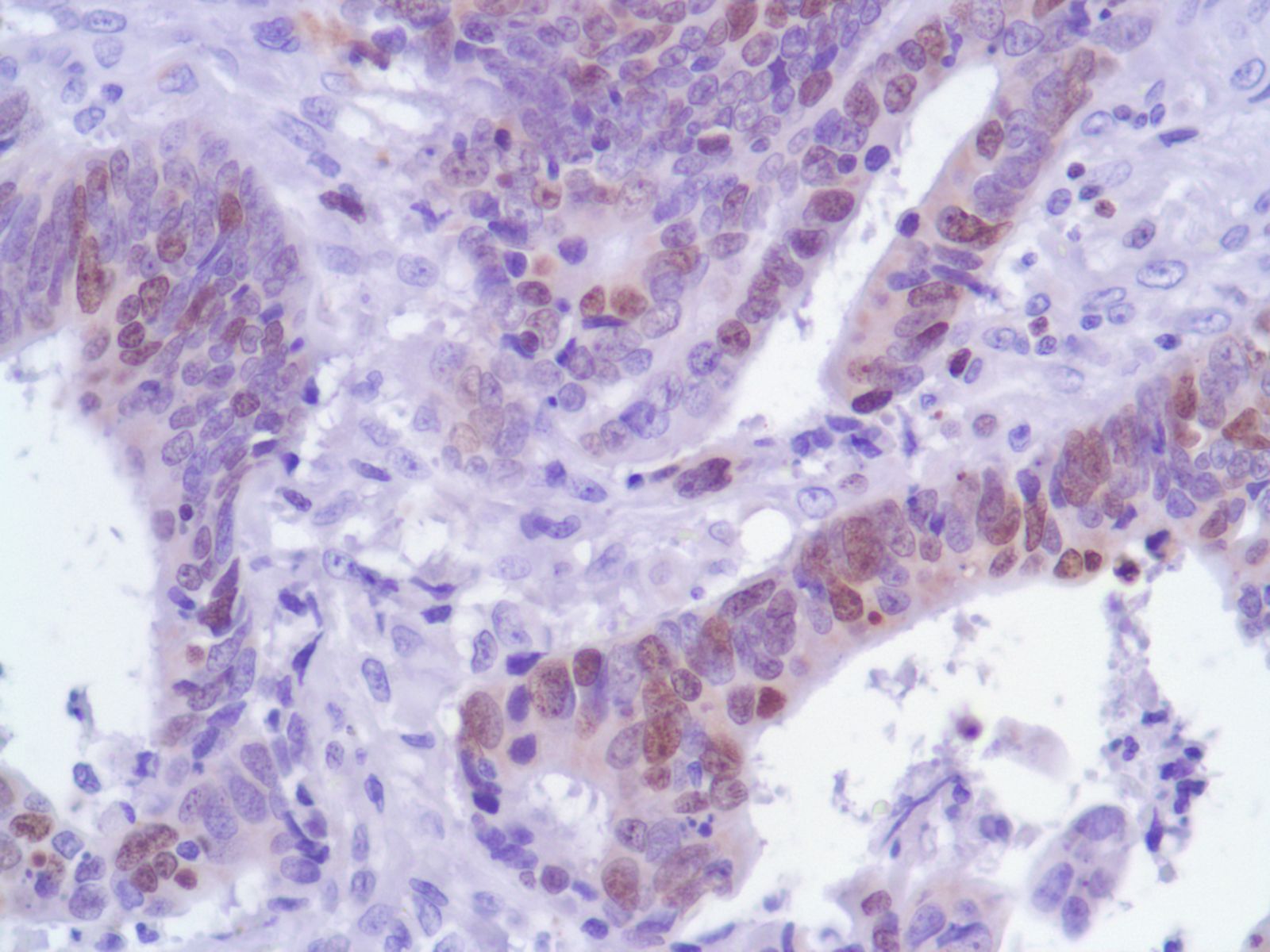 anti-Ki-67 抗体 [SP6] (ARG53222) - arigobio 中国