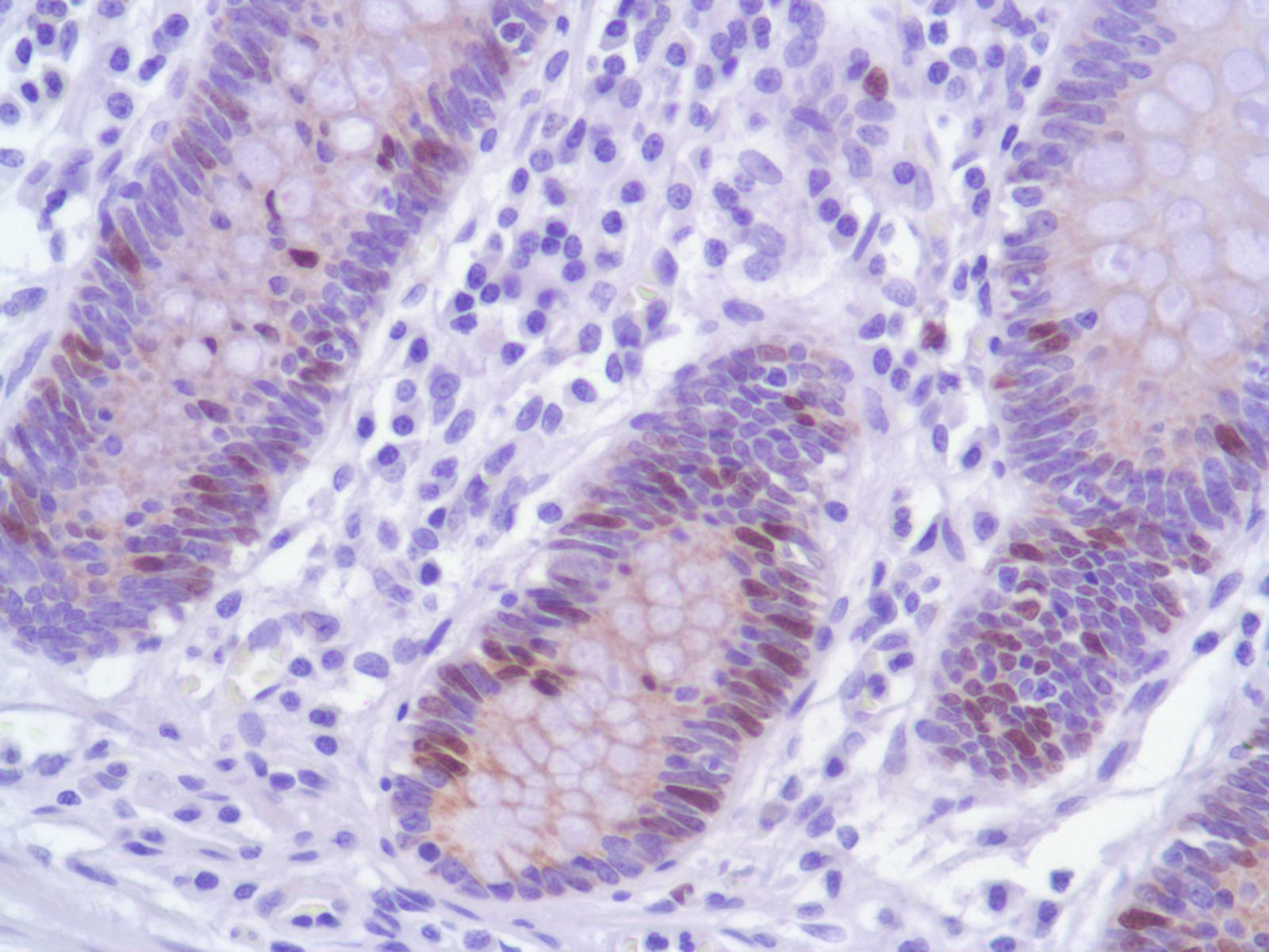 anti-Ki-67 抗体 [SP6] (ARG53222) - arigobio 中国