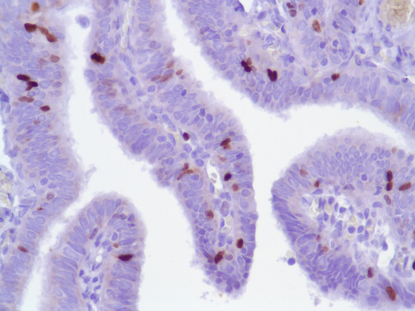 anti-Ki-67 抗体 [SP6] (ARG53222) - arigobio 中国