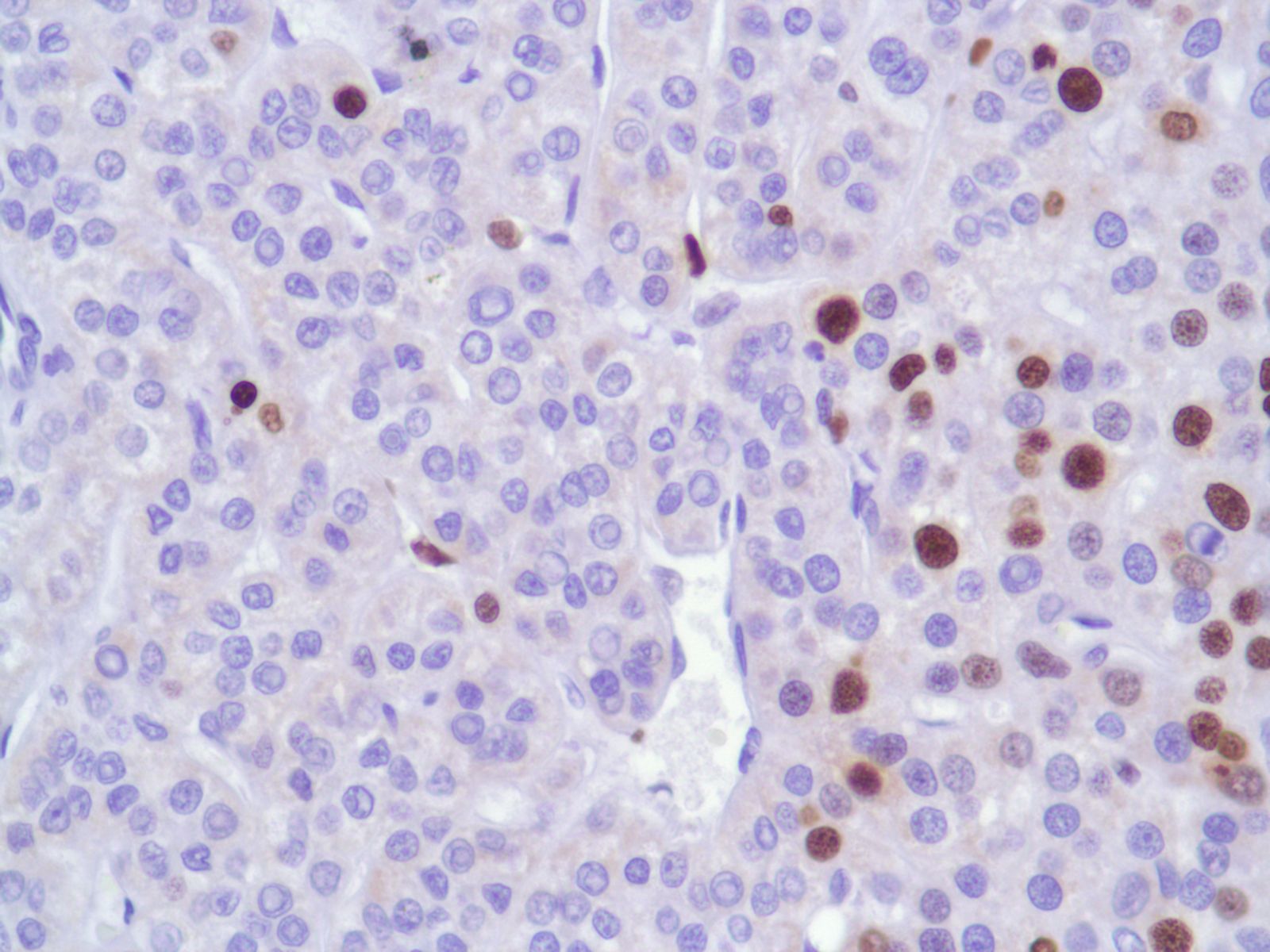 anti-Ki-67 抗体 [SP6] (ARG53222) - arigobio 中国