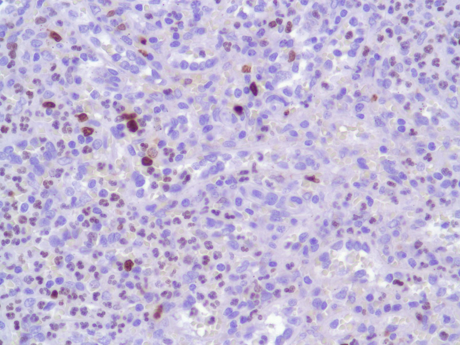 anti-Ki-67 antibody [SP6] (ARG53222) - Product - Arigo biolaboratories