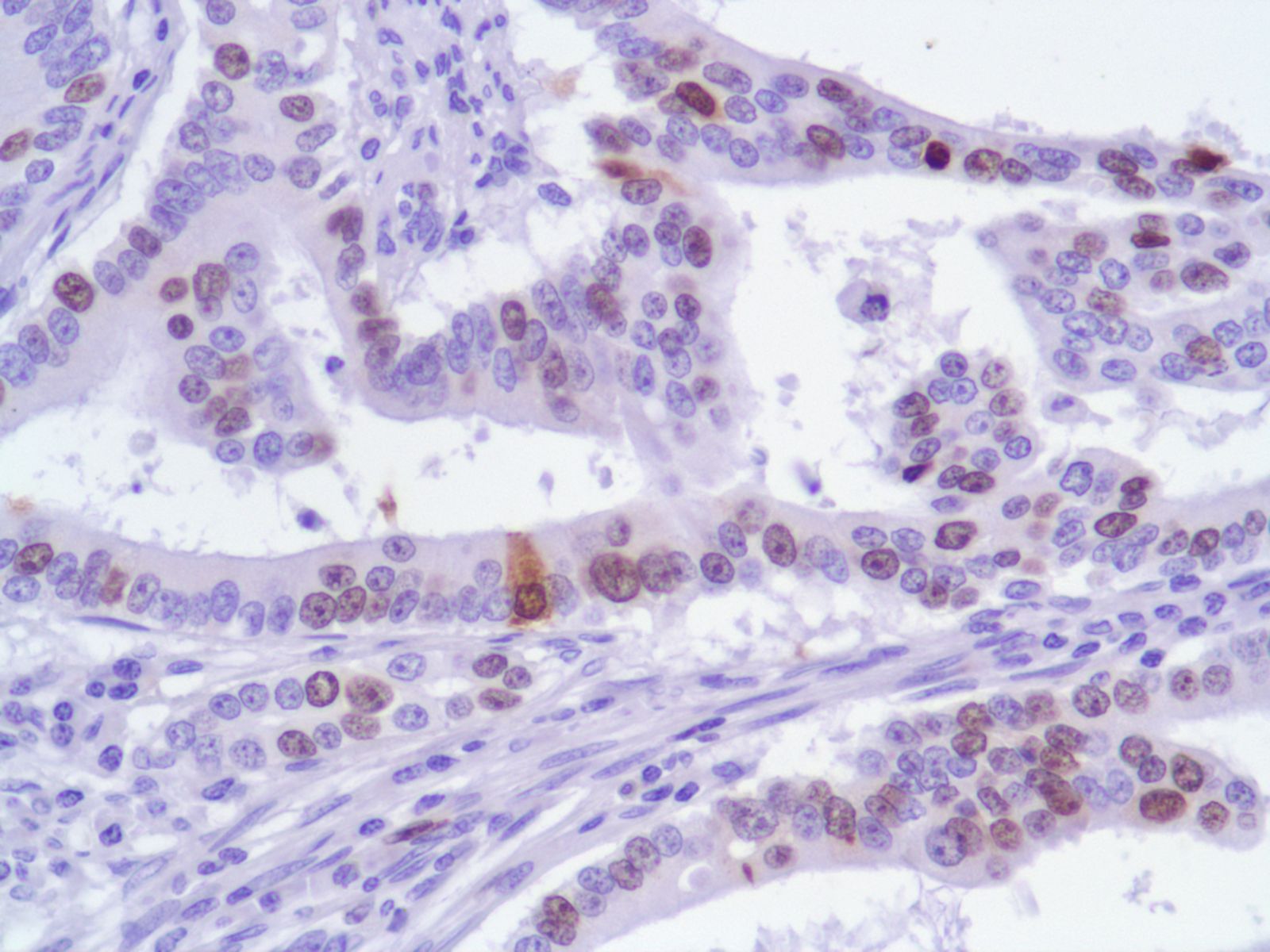 anti-Ki-67 抗体 [SP6] (ARG53222) - arigobio 中国