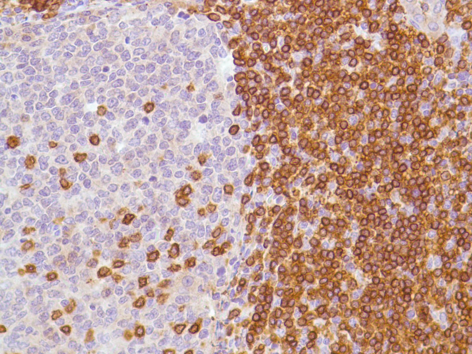 anti-CD3 抗体 [SP7] (ARG52744) - arigobio 中国