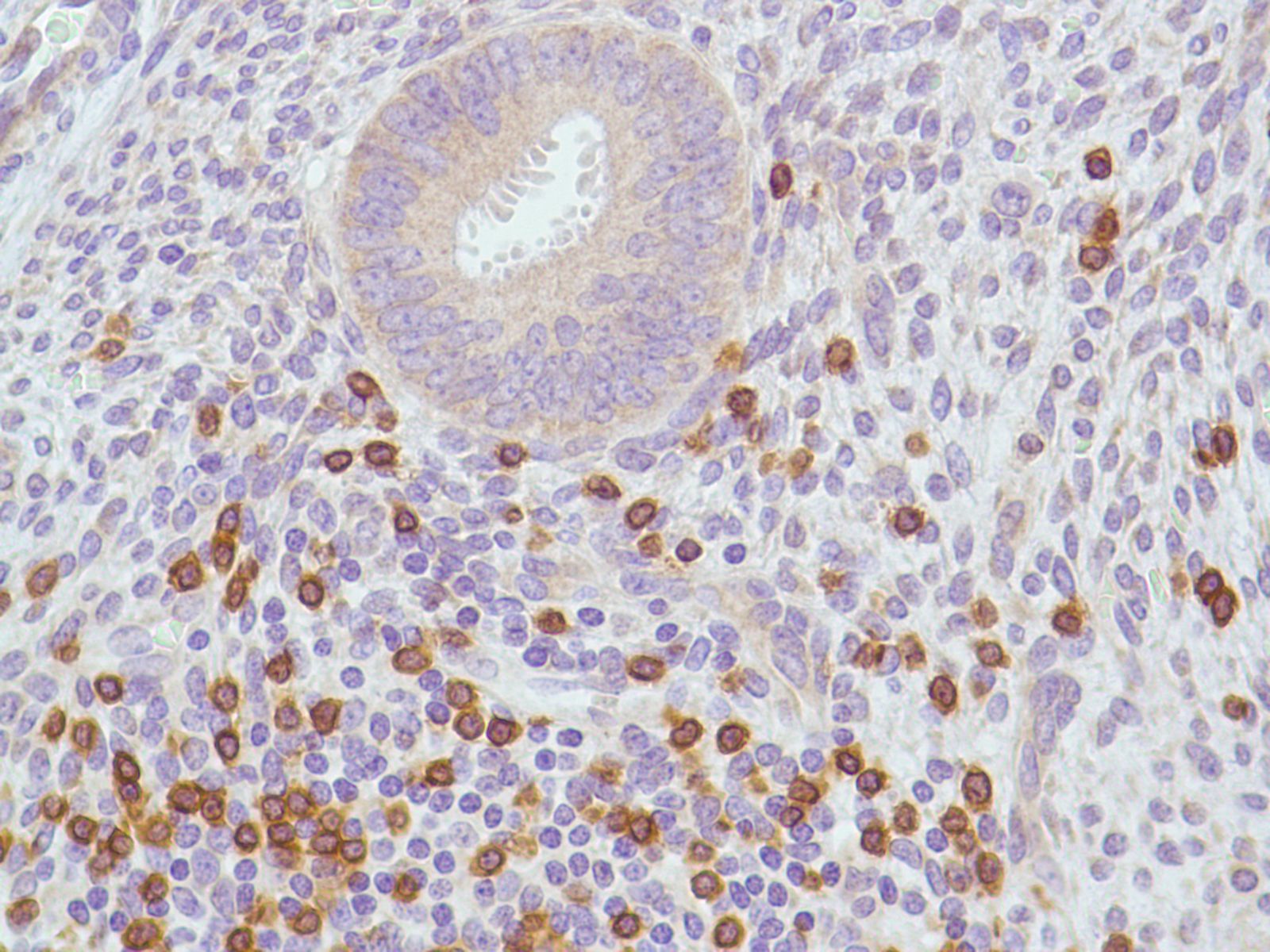 anti-CD3 抗体 [SP7] (ARG52744) - arigobio 中国