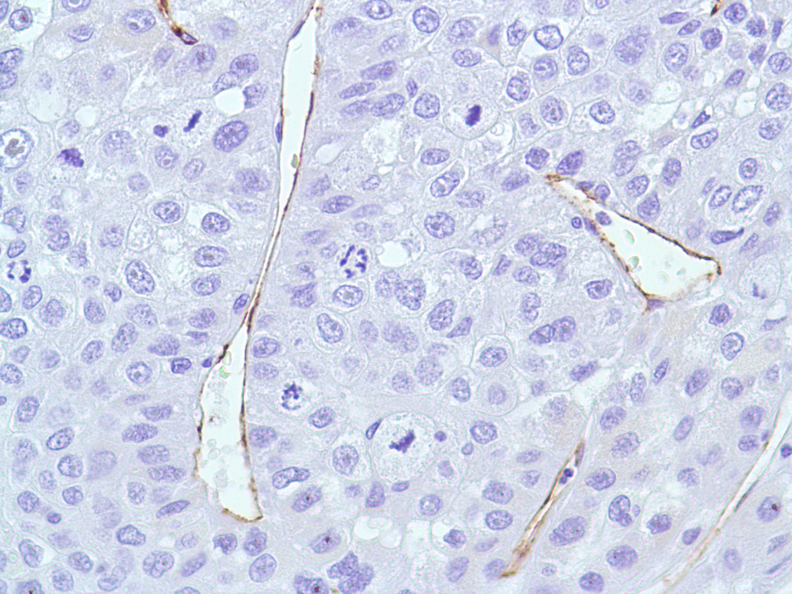 Endothelial Cell Marker Antibody Duo (CD31, CD34) (ARG30095) - Arigo ...