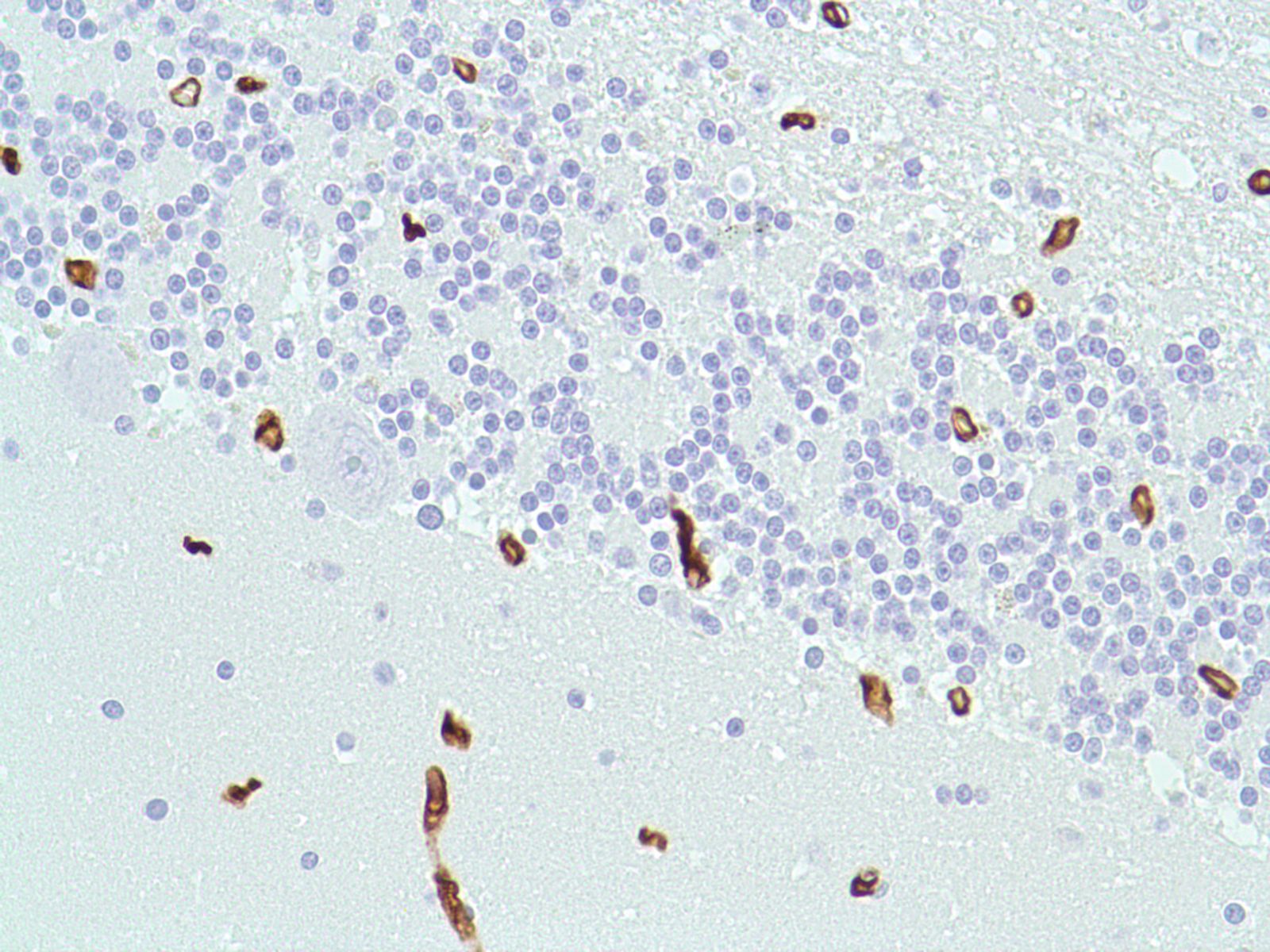 Endothelial Cell Marker 抗体组 (CD31, CD34) (ARG30300) - arigobio 中国