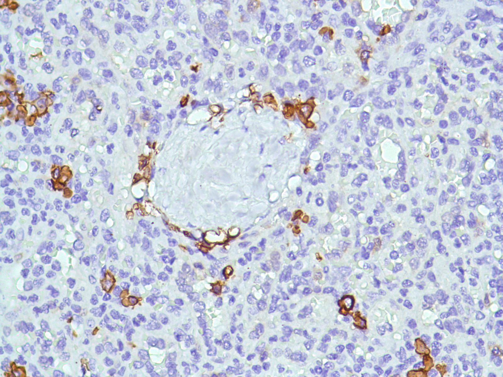 Pro-B Cell Marker 抗体 panel (CD19, CD34, CD38, CD40, CD45) (FACS ...