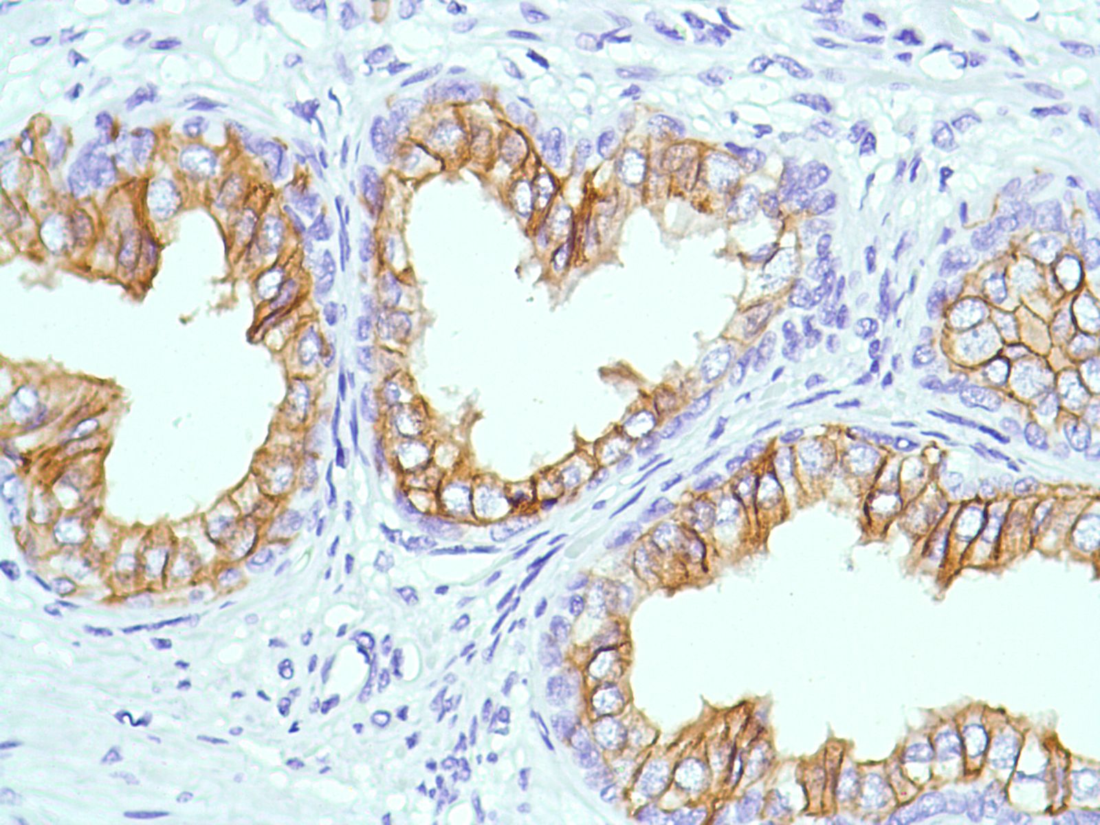 Pro-B Cell Marker 抗体 panel (CD19, CD34, CD38, CD40, CD45) (FACS ...