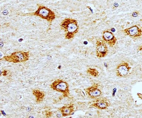 anti-uPAR 抗体 (ARG55704) - arigobio 中国