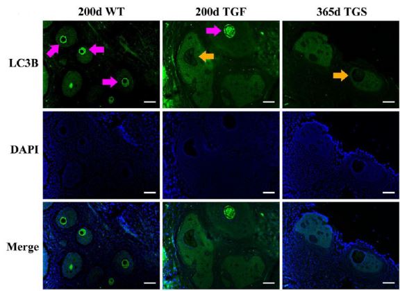 anti-LC3B 抗体 (ARG55799) - arigobio